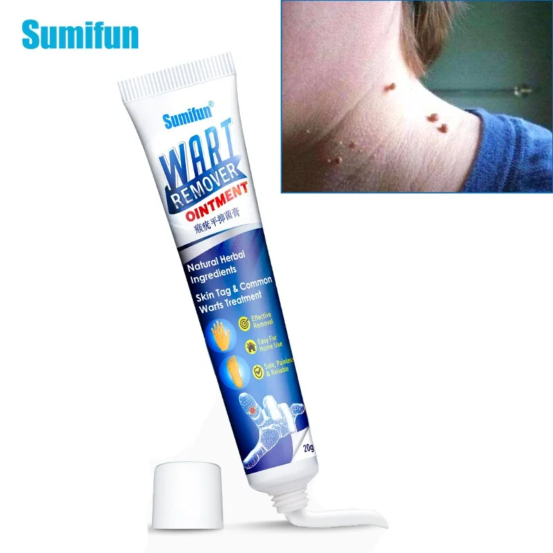 Pommade contre les verrues et les grains de beauté. – kinshashop