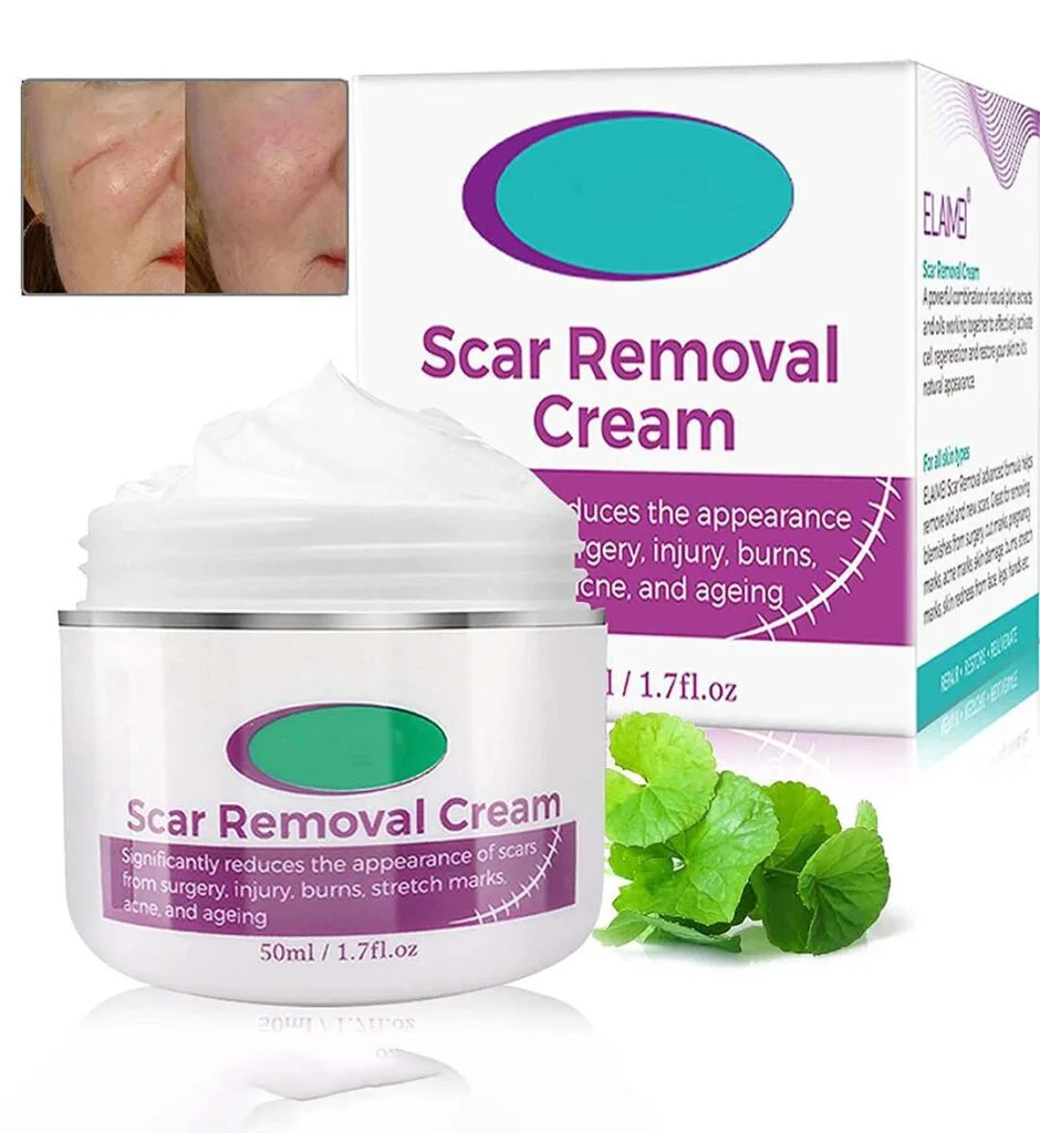 MAGIC SCAR REMOVAL CREAM-كريم إزالة الندبات