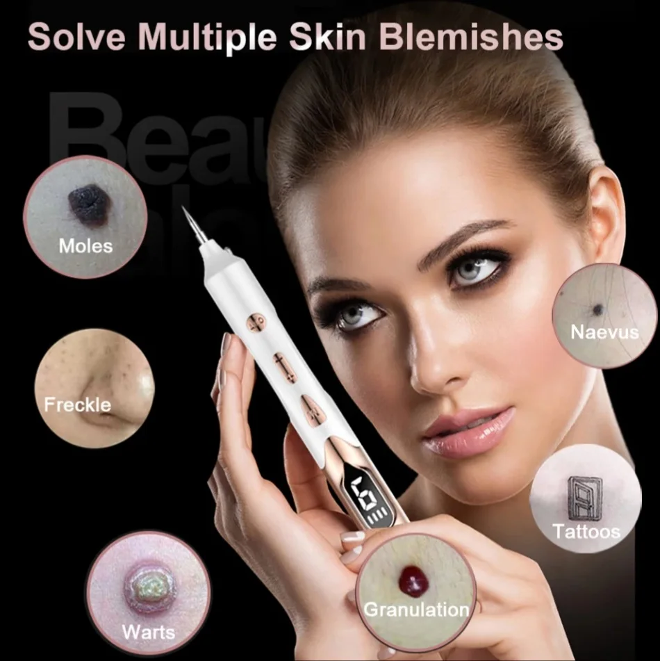 Laser Plasma pen les taupes, les verrues, les taches de rousseur et les ...