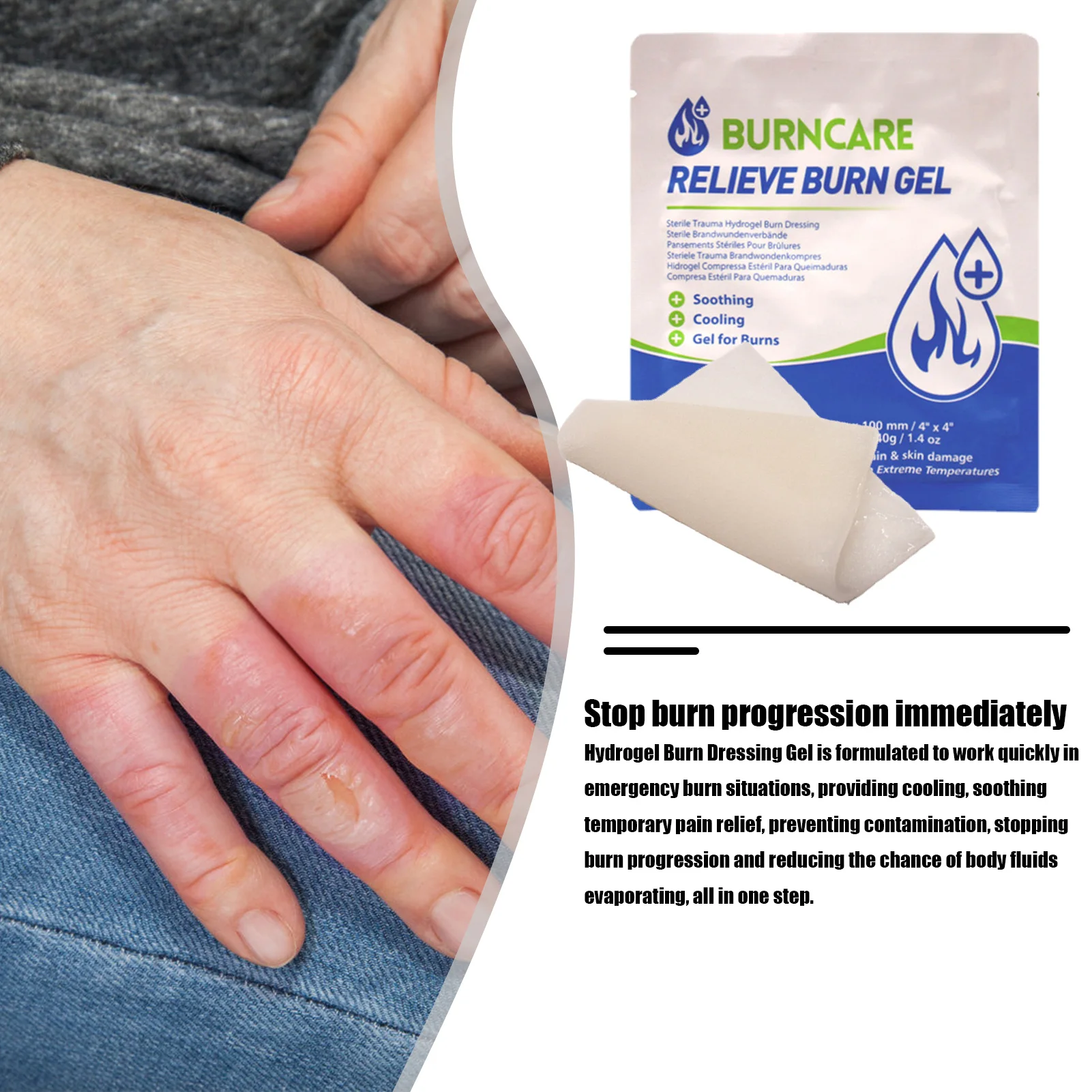 Burncare Relieve Burn Gel: Cooling & Soothing Hydrogel Wound Dressing ...