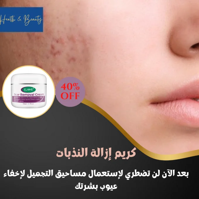 Magic scar removal cream